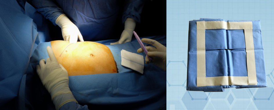 Surgical Drapes Manufacturers in Hyderabad